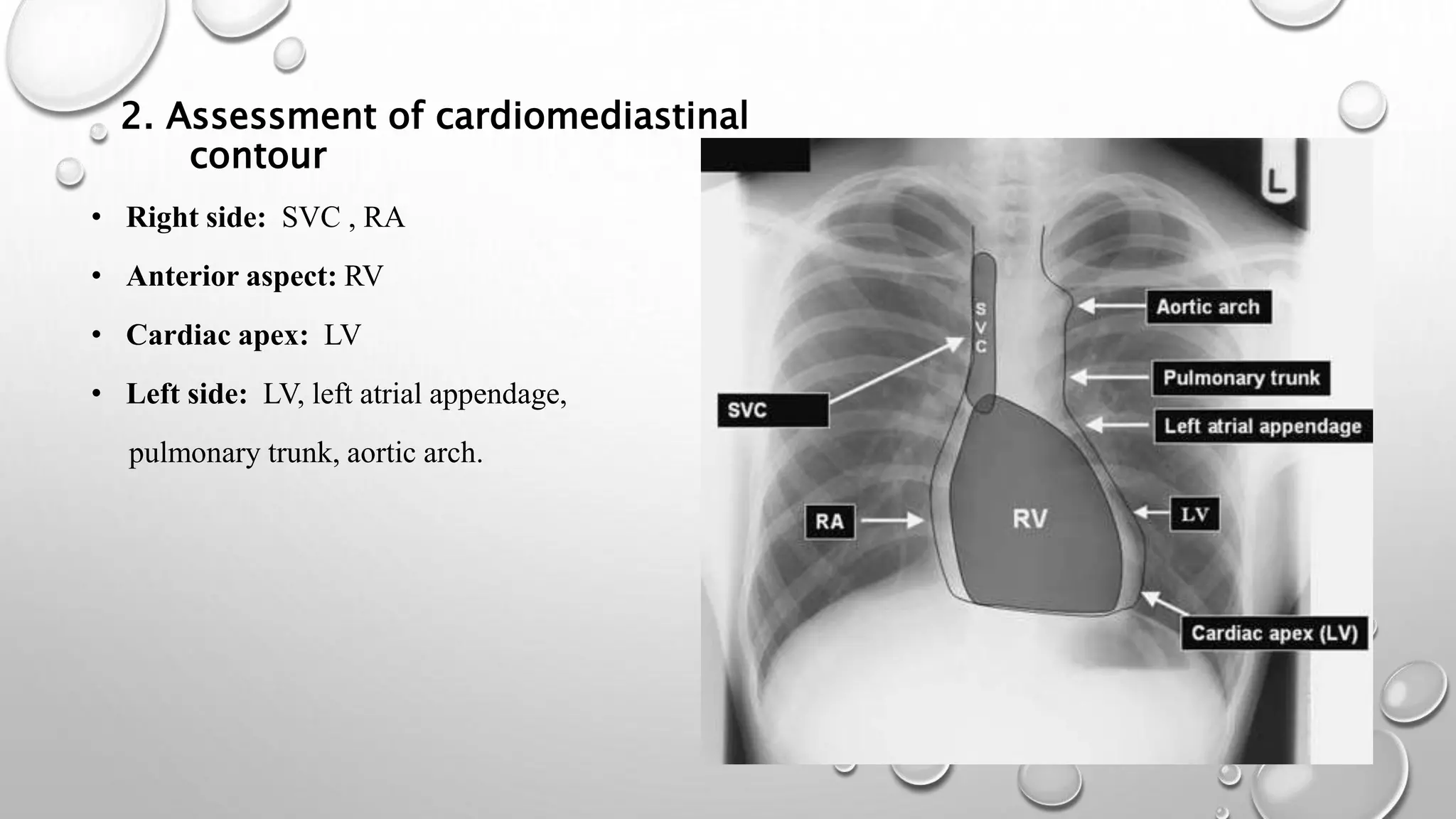 Approach to cxr.pptx