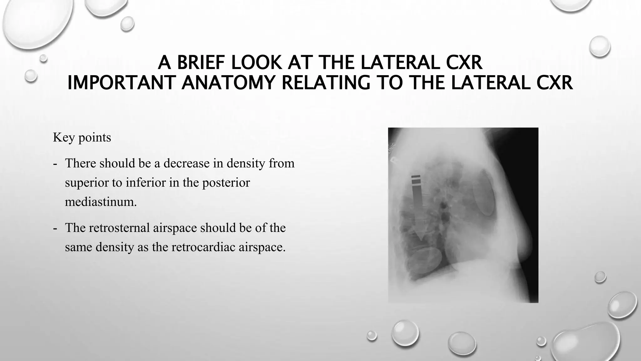 Approach to cxr.pptx