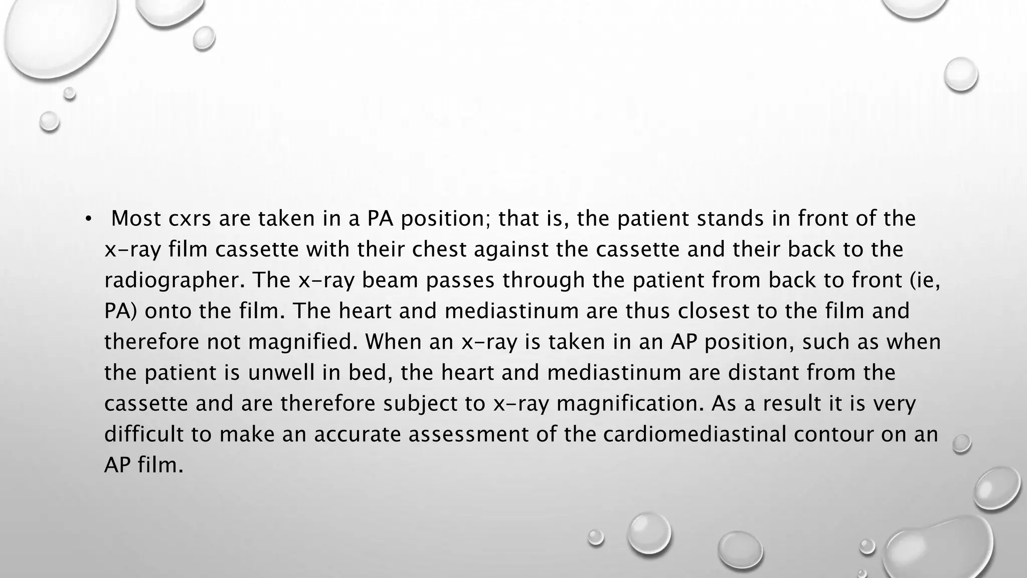 Approach to cxr.pptx