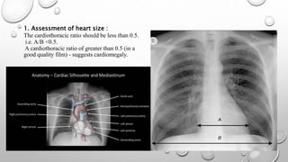Approach to cxr.pptx