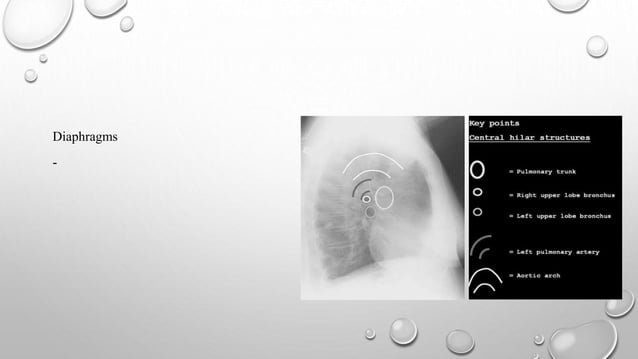 Approach to cxr.pptx
