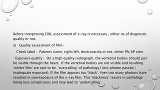 Approach to cxr.pptx