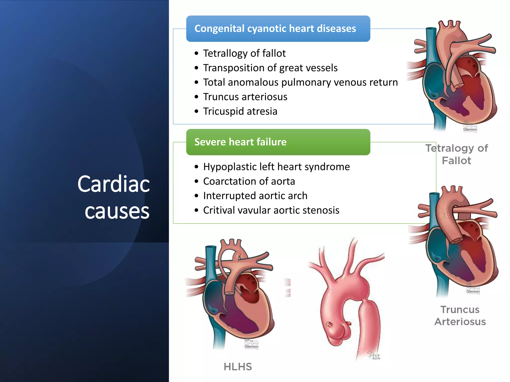 Approach to Cyanosis [Paediatrics presentation for medical (MBBS ...