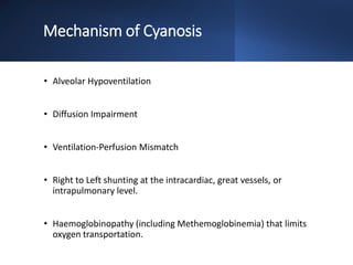 Approach to Cyanosis [Paediatrics presentation for medical (MBBS ...