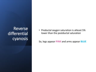Approach to Cyanosis [Paediatrics presentation for medical (MBBS ...