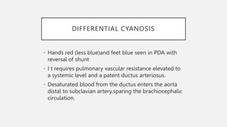 APPROACH TO CYANOSIS .pptx