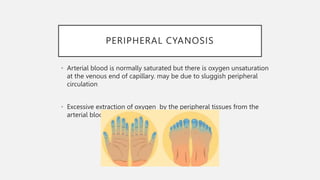 APPROACH TO CYANOSIS .pptx