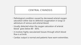 APPROACH TO CYANOSIS .pptx