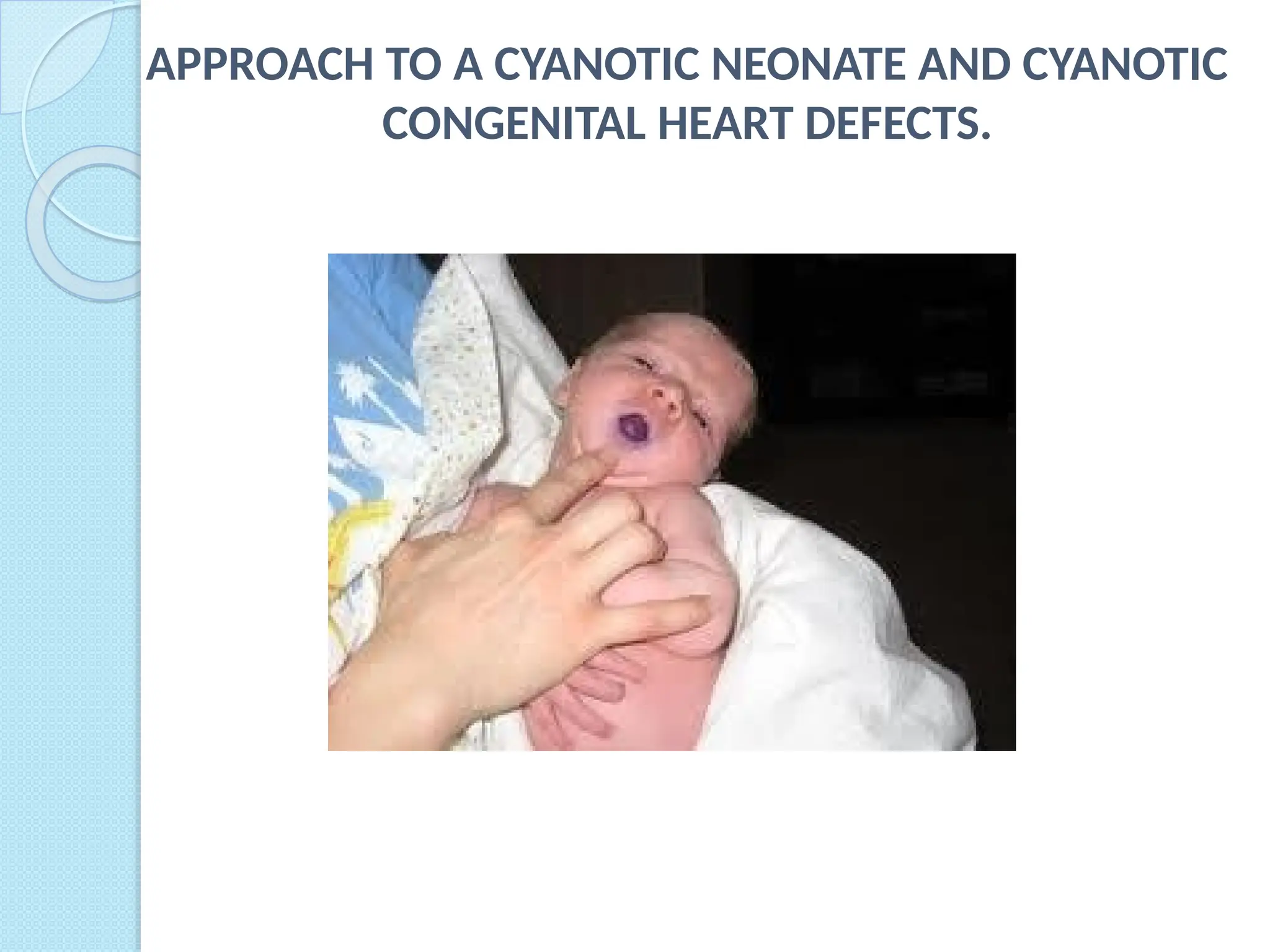 approach to cyanosis REWIND (1) (1).pptx
