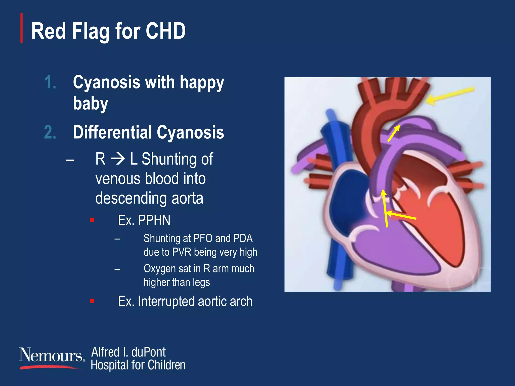 Approach to cyanotic chd | PPTX