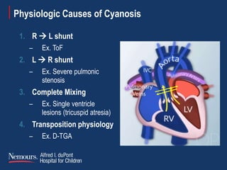 Approach to cyanotic chd | PPTX