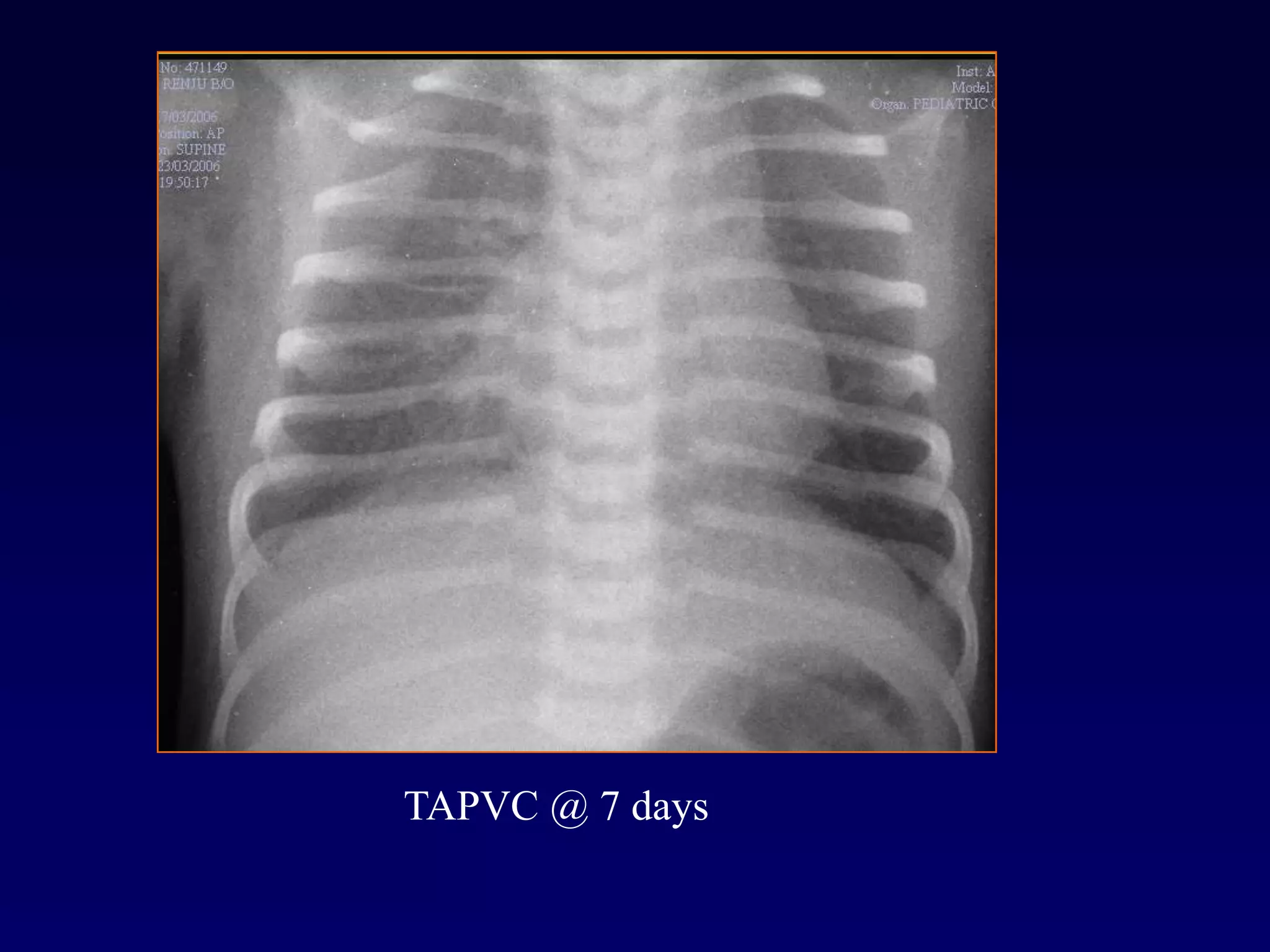 Chd Clinical Approach Pdf