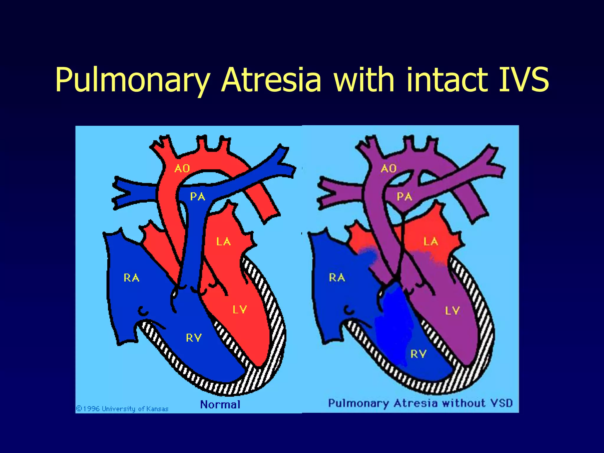 CHD Clinical approach.pdf