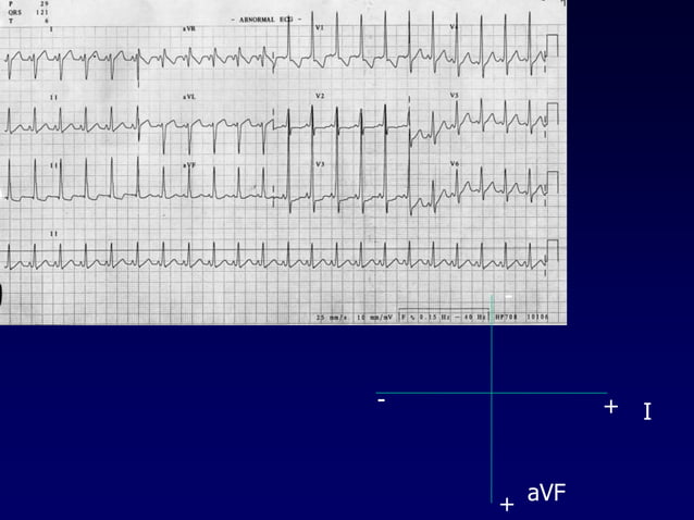 Chd Clinical Approach Pdf Heart And Cardiovascular Diseases
