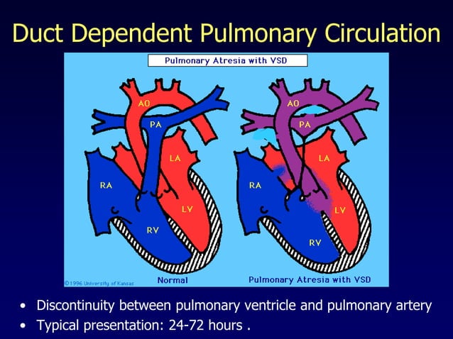 CHD Clinical approach.pdf | Heart and Cardiovascular Diseases ...