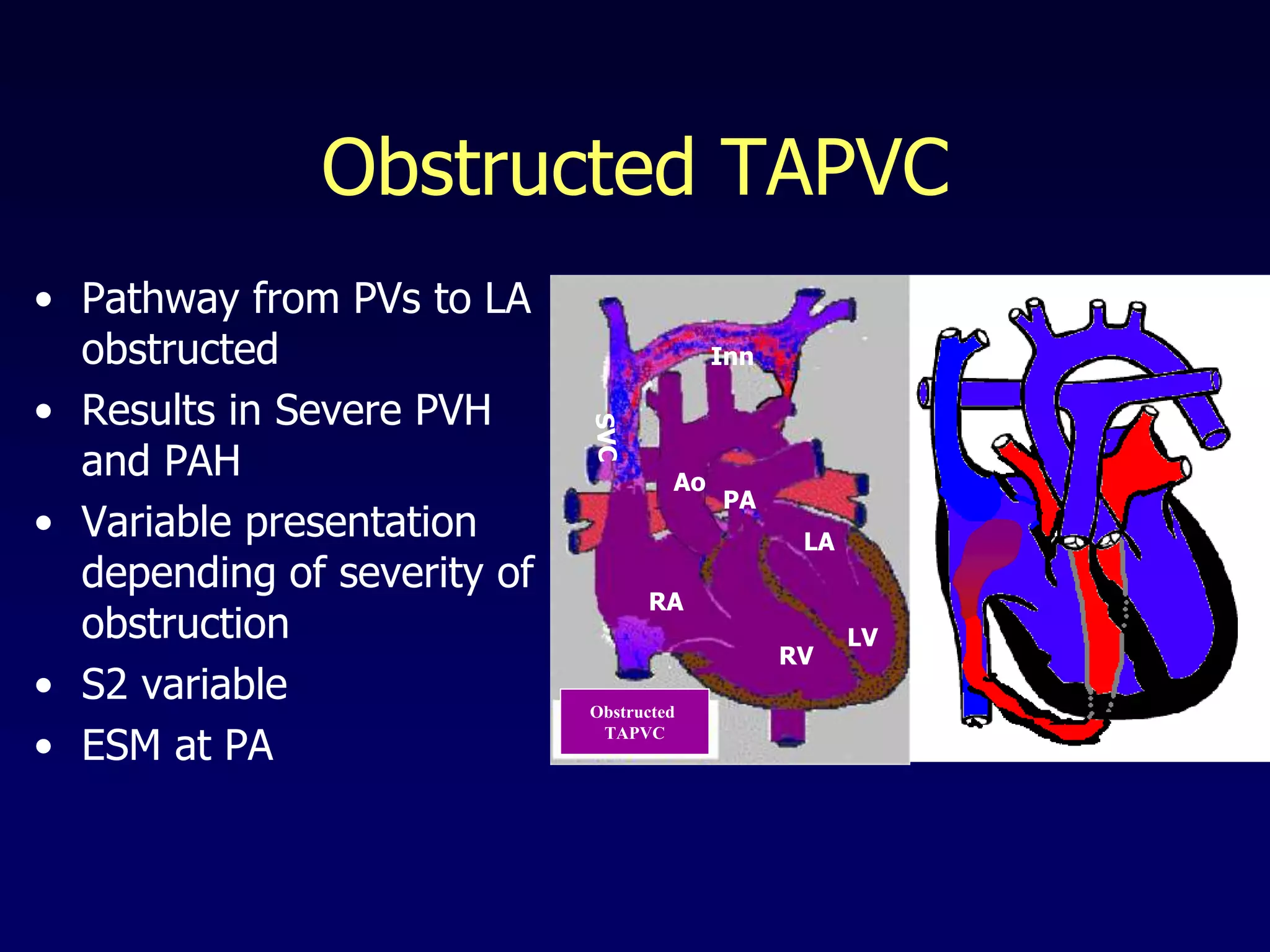 Approach to cyanotic congenital heart disease | PPTX