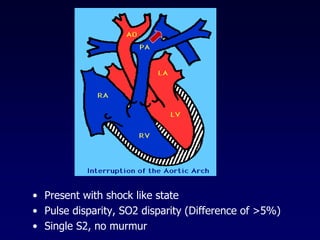 Approach to cyanotic congenital heart disease | PPTX