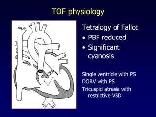 Approach to cyanotic congenital heart disease | PPTX