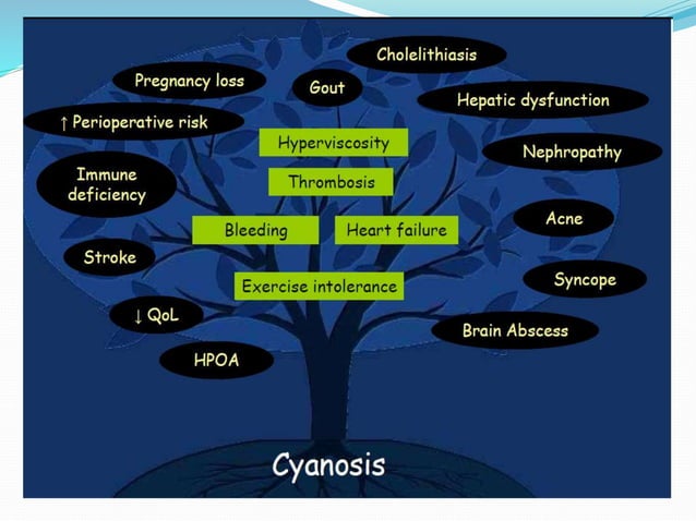 Approach to cyanotic congenital heart diseases | PPTX | Heart and ...