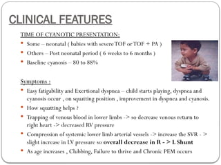 APPROACH TO CYANOTIC HEART DISEASES.pptx