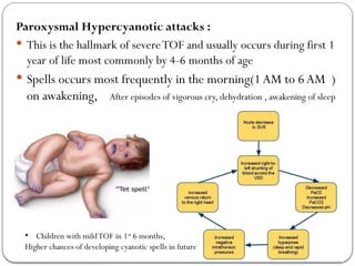 APPROACH TO CYANOTIC HEART DISEASES.pptx