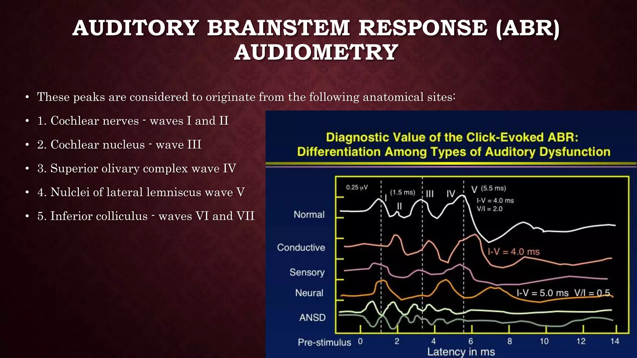 Approach to deafness | PPTX