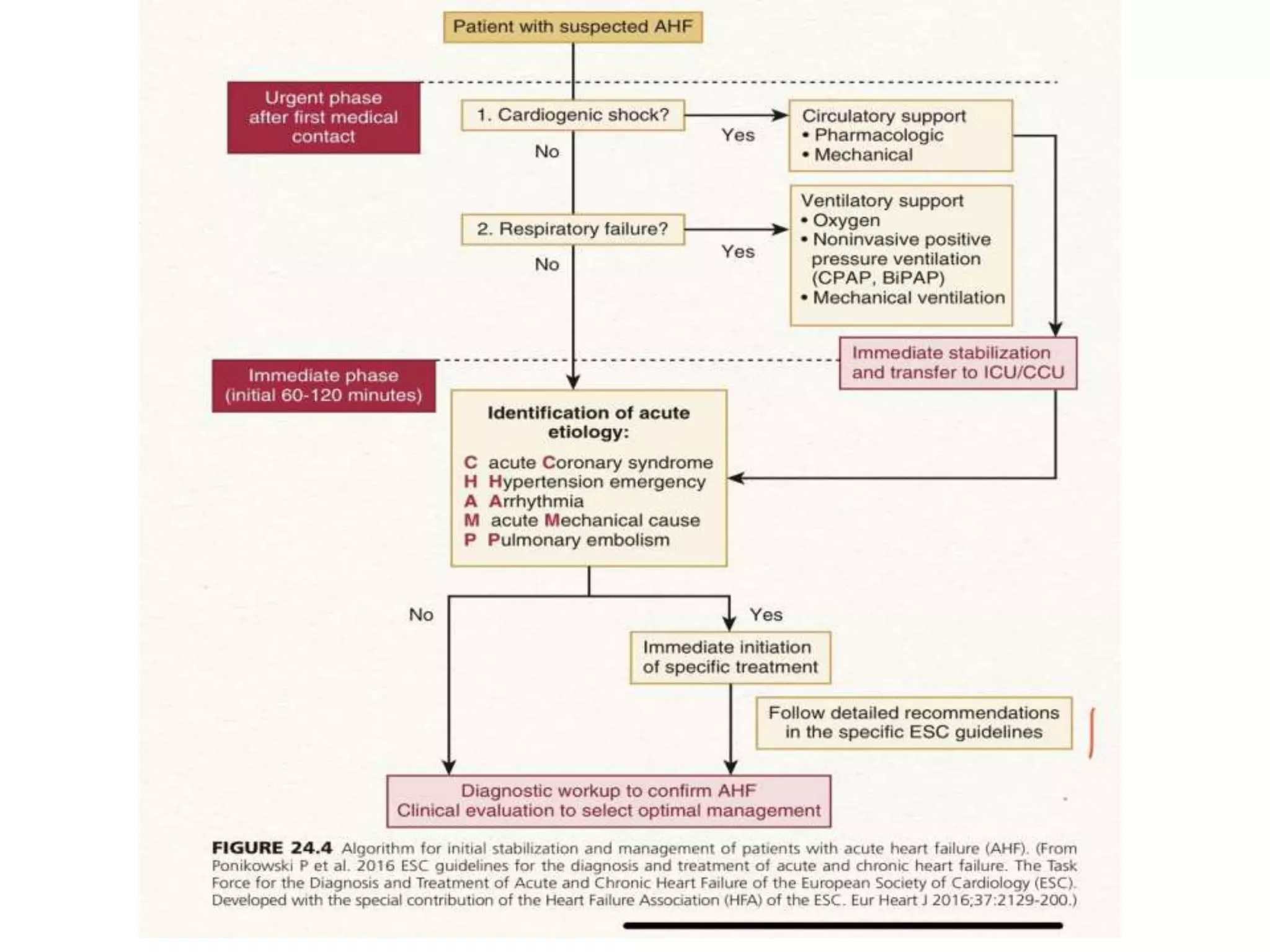 Decompansated heart failure | PPTX