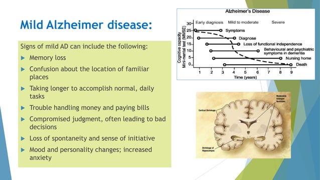 Approach to dementia and alzheimers s | PPTX