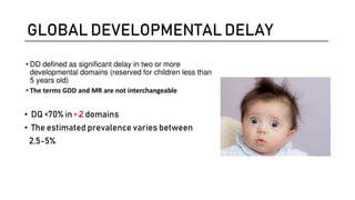APPROACH TO DEVELOPMENT DELAY.pptx
