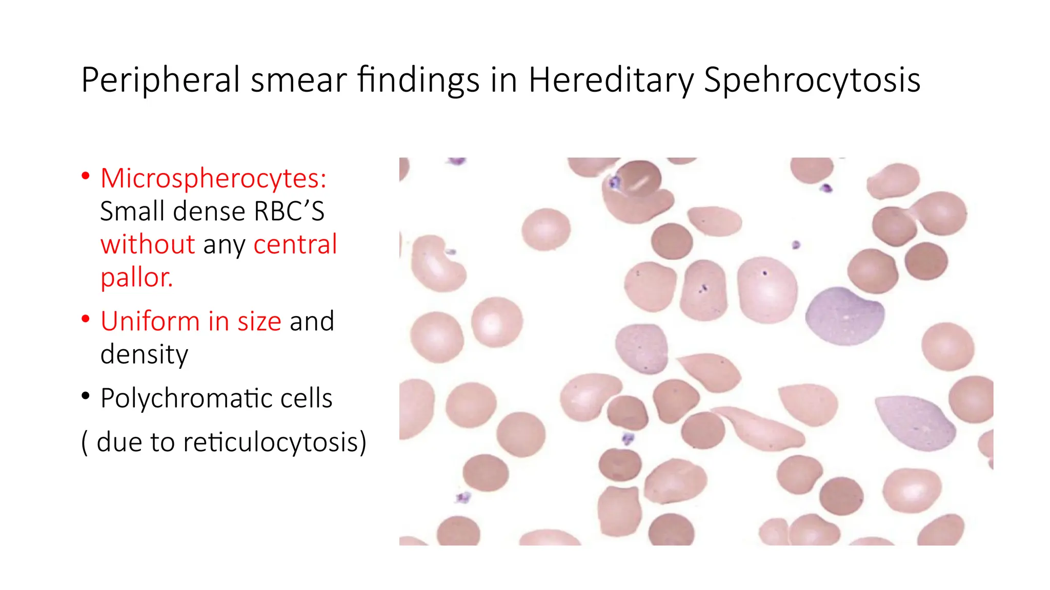 Approach to diagnosis of hemolytic anemia.pptx