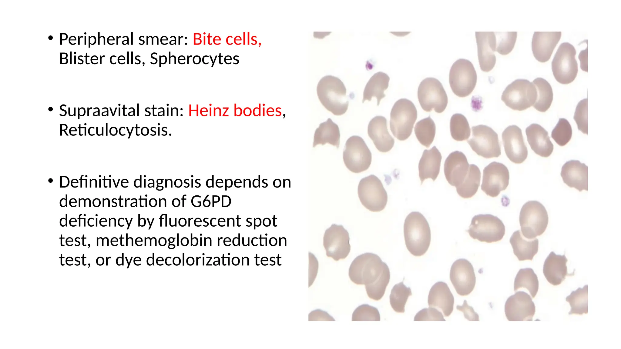 Approach to diagnosis of hemolytic anemia.pptx