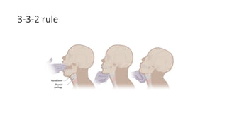 APPROACH TO DIFFICULT AIRWAY2222222.pptx