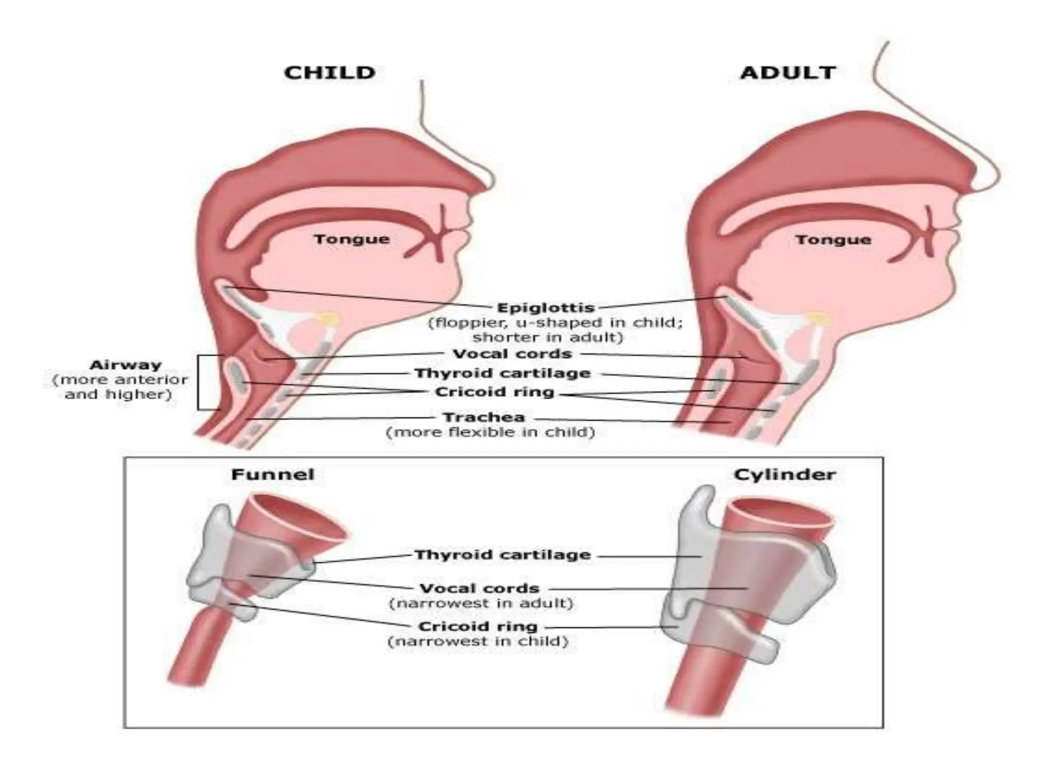 Approach to Difficult and Compromised Airway in Neonatal.pptx