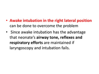 Approach to Difficult and Compromised Airway in Neonatal.pptx
