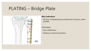 Approach to distal ulna.pptx