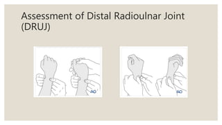 Approach to distal ulna.pptx