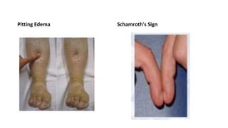 Approach To Dyspnea | PPTX