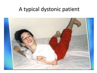 Approach to dystonia | PPTX