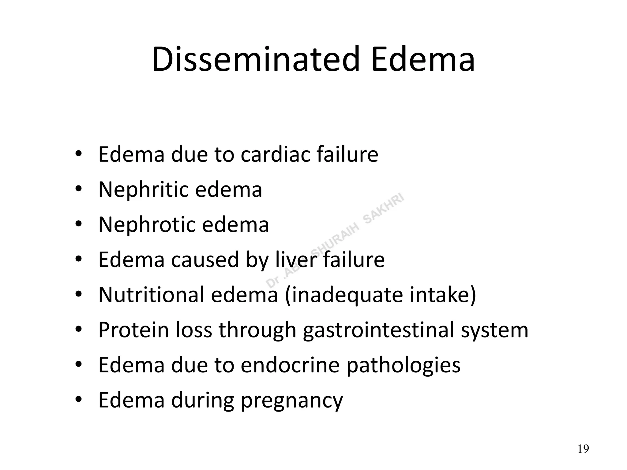 Approach to edema | PPT