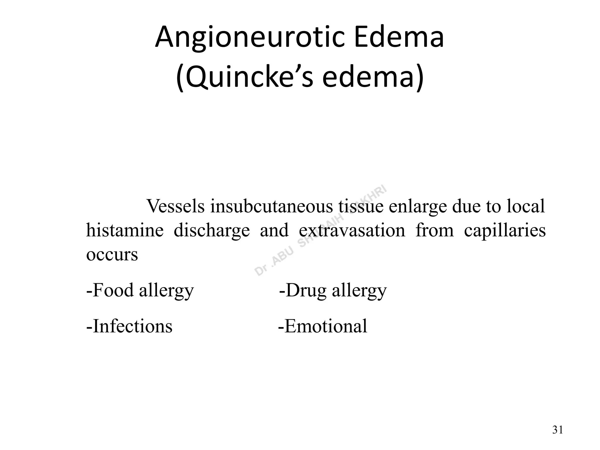 Approach to edema | PPT