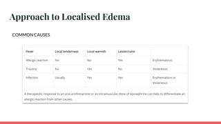 Approach to Edema in Paediatrics. | PDF