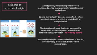APPROACH TO EDEMA - Dr.Harishma | PDF