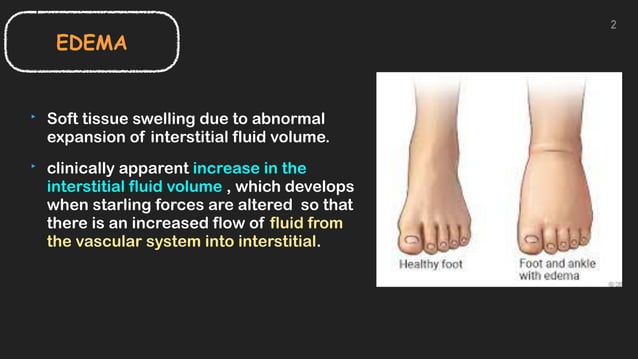 APPROACH TO EDEMA - Dr.Harishma | PDF