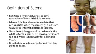 APPROACH TO EDEMA | PPTX