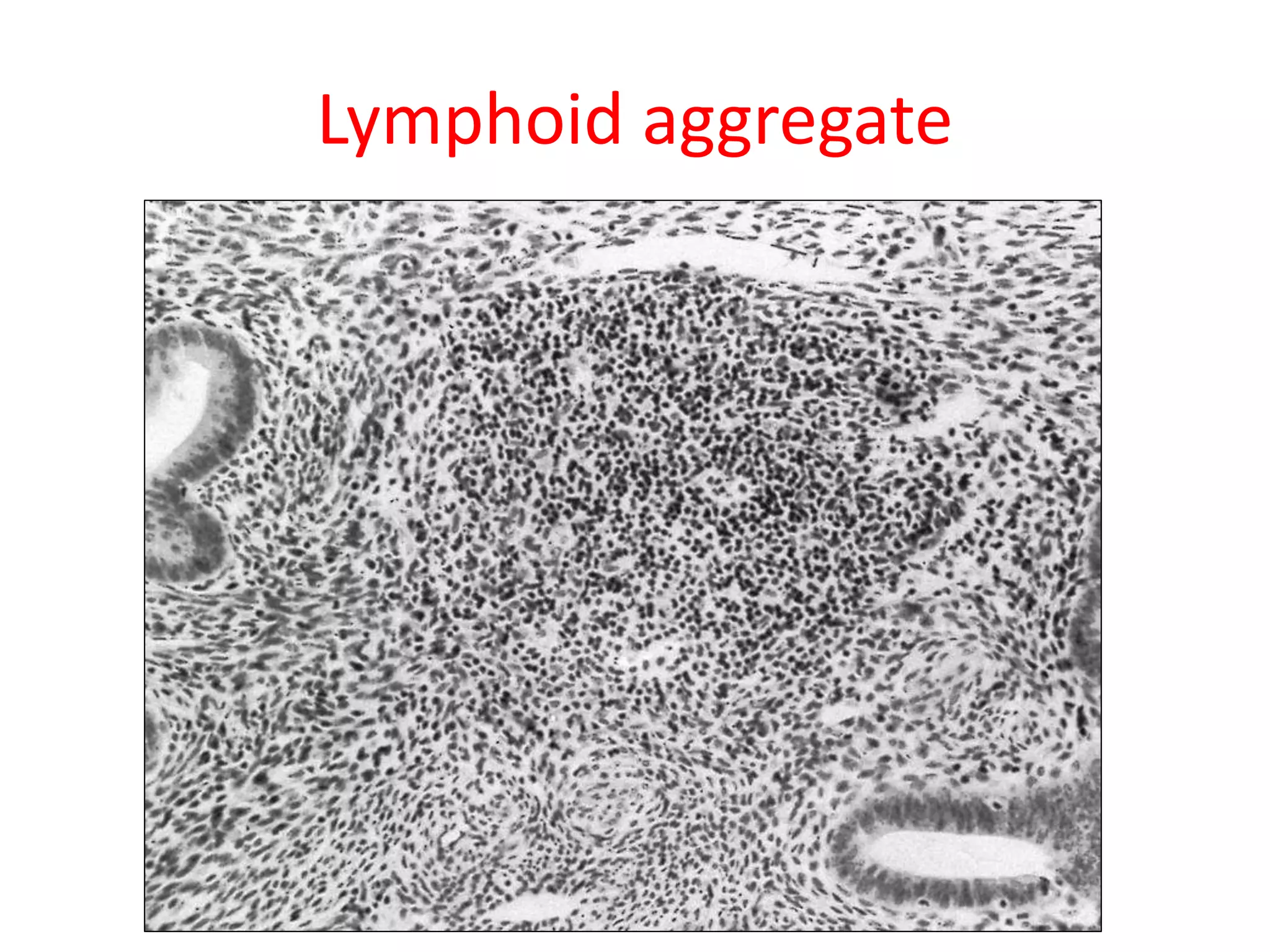 Approach to endometrial biopsy | PPTX