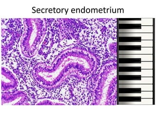 Approach to endometrial biopsy | PPTX