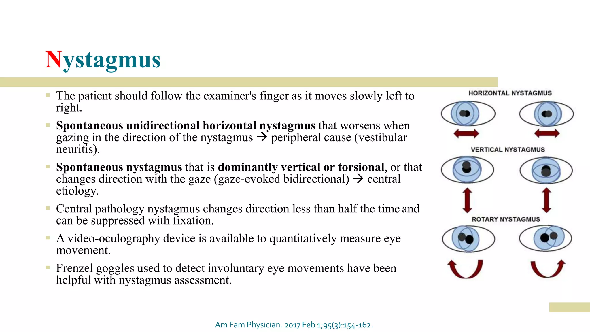 Approach to evaluation and management of acute vertigo | PPTX