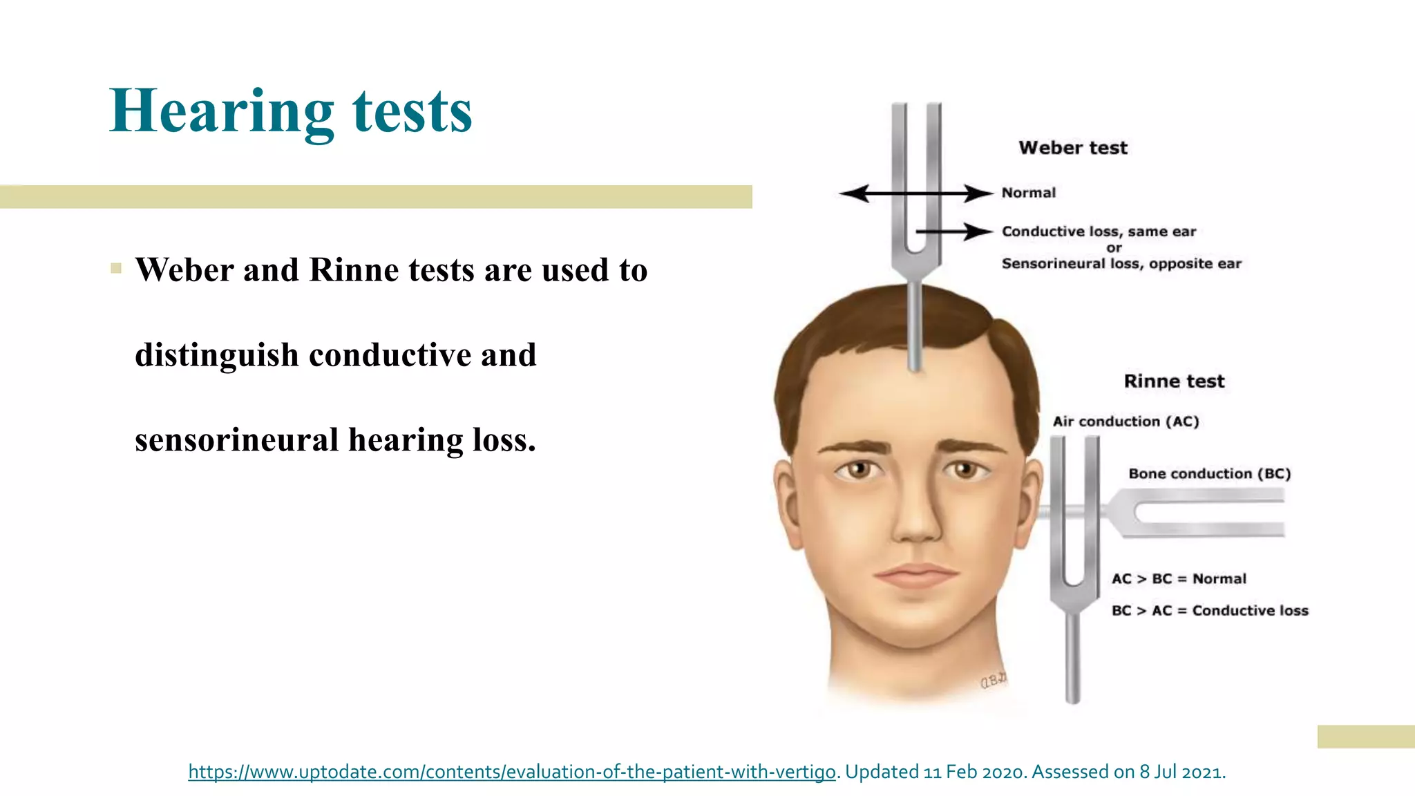 Approach to evaluation and management of acute vertigo | PPTX