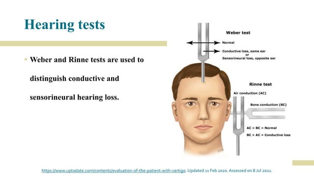 Approach to evaluation and management of acute vertigo | PPTX | Brain ...
