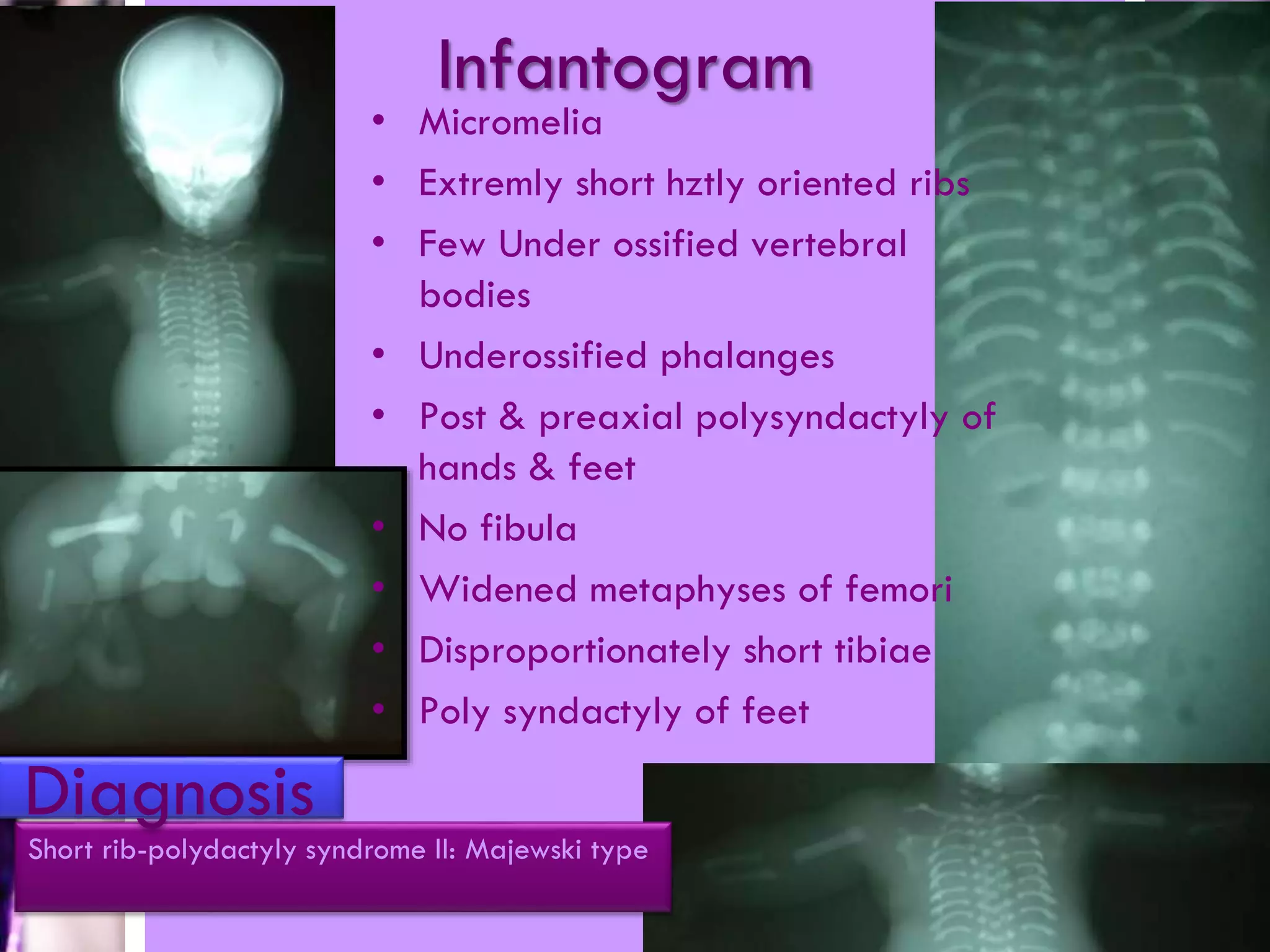 Approach to ext skel anomaly survey . Dr Saneej . PRIZE WINNER | PPTX